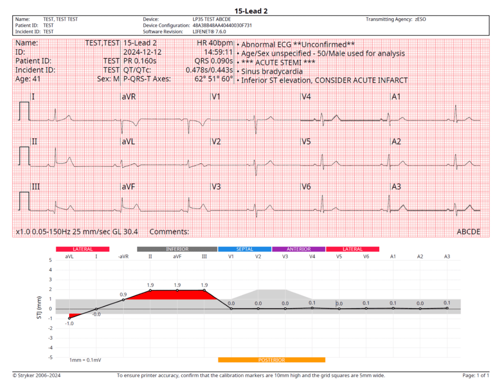 (Q4/2024) ESO Updates: Quarterly Product Enhancements - ESO